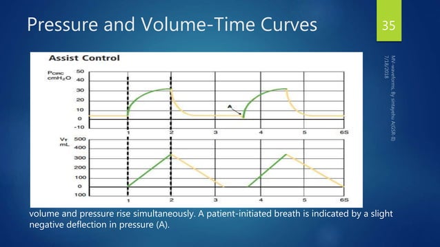 Mechanical ventilation wave forms | PPTX | Lung and Respiratory Health ...