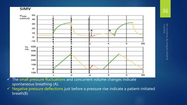 Mechanical ventilation wave forms | PPTX | Lung and Respiratory Health ...