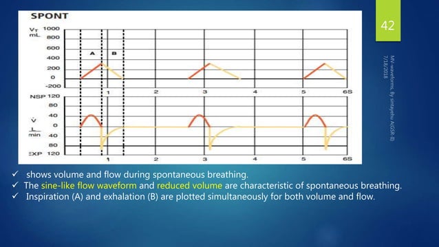 Mechanical ventilation wave forms | PPTX | Lung and Respiratory Health ...