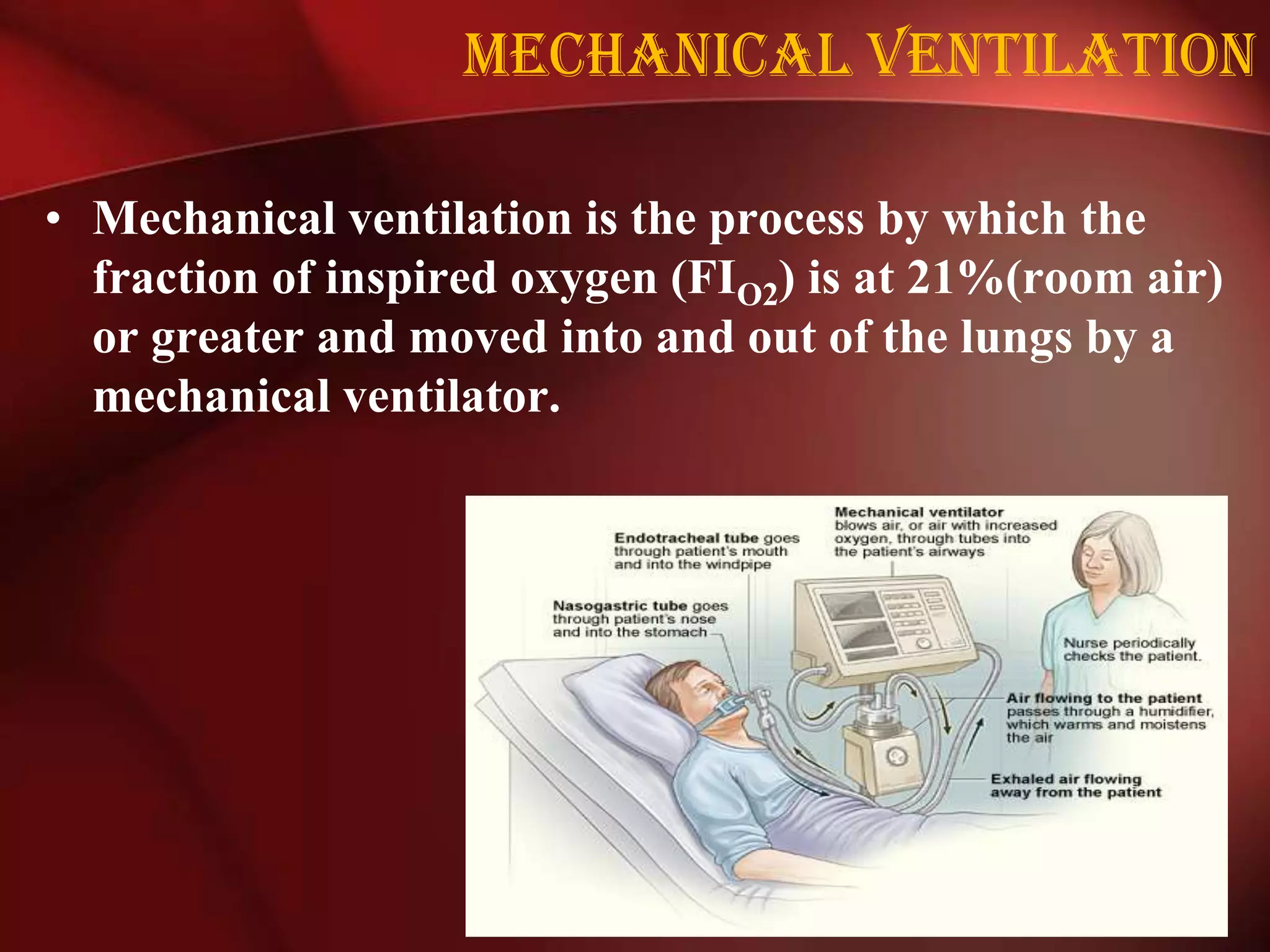 Mechanical ventilator | PPTX