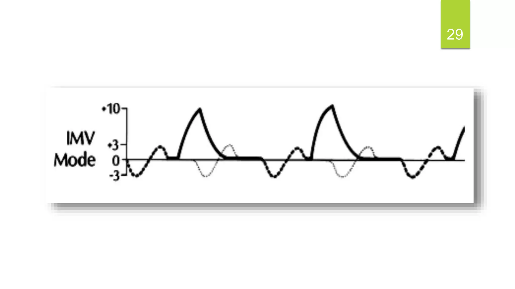 Mechanical ventilator basic setting and modes | PPT