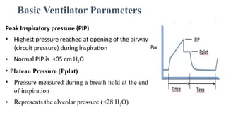 mechanical ventilator basics anesthesia.pptx