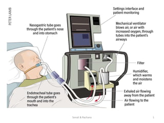 Mechanical Ventilation | PPTX