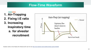 Mechanical vent rules to know while taking the TMC | PPT