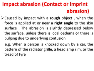 MECHANICLINJURIESABSIONCONTUSON-laceration, incised etc | PPTX