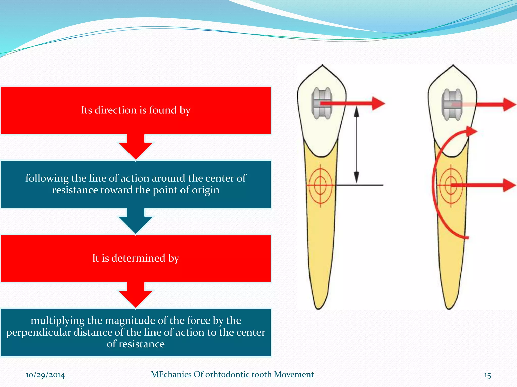Mechanics of Orthodontic tooth movement | PPTX