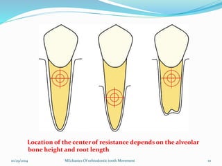 Mechanics of Orthodontic tooth movement | PPTX