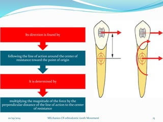 Mechanics of Orthodontic tooth movement | PPTX