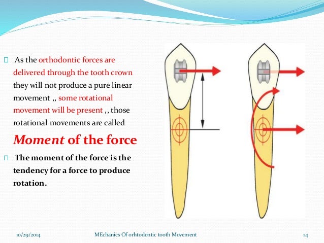 Mechanics of Orthodontic tooth movement