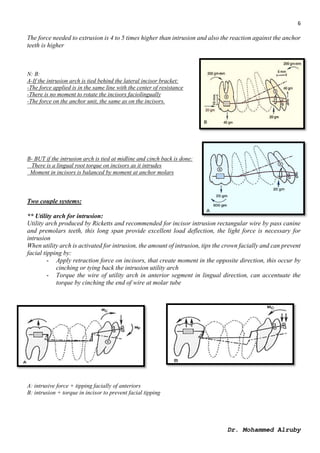 mechanics in orthodontic part 2.docx