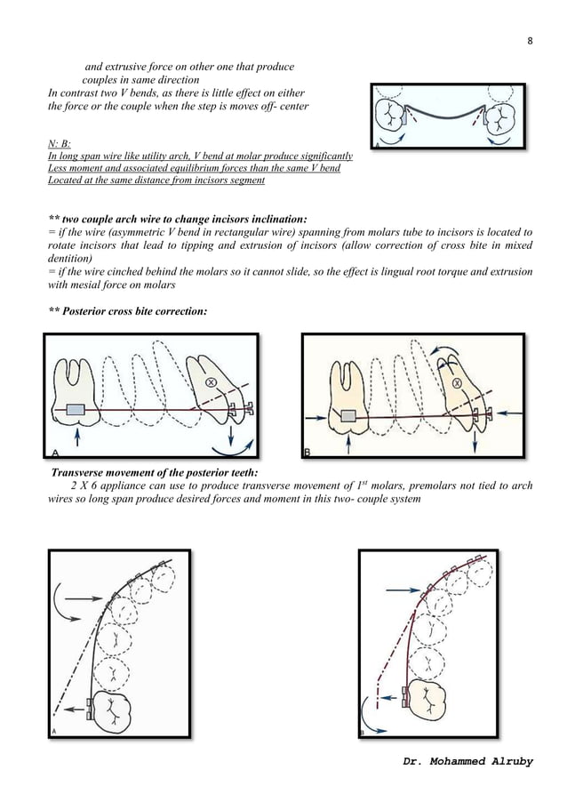 mechanics in orthodontic part 2.docx