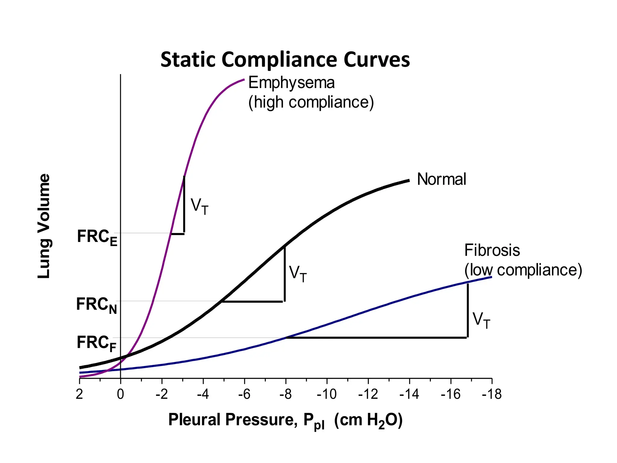 Mechanics_of_Breathing_(Pulmonary Ventilation)_Physiology_16-11-2018.pdf