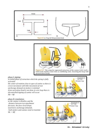 mechanics of extraction space closure.docx