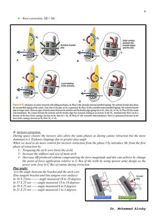 mechanics of extraction space closure.docx