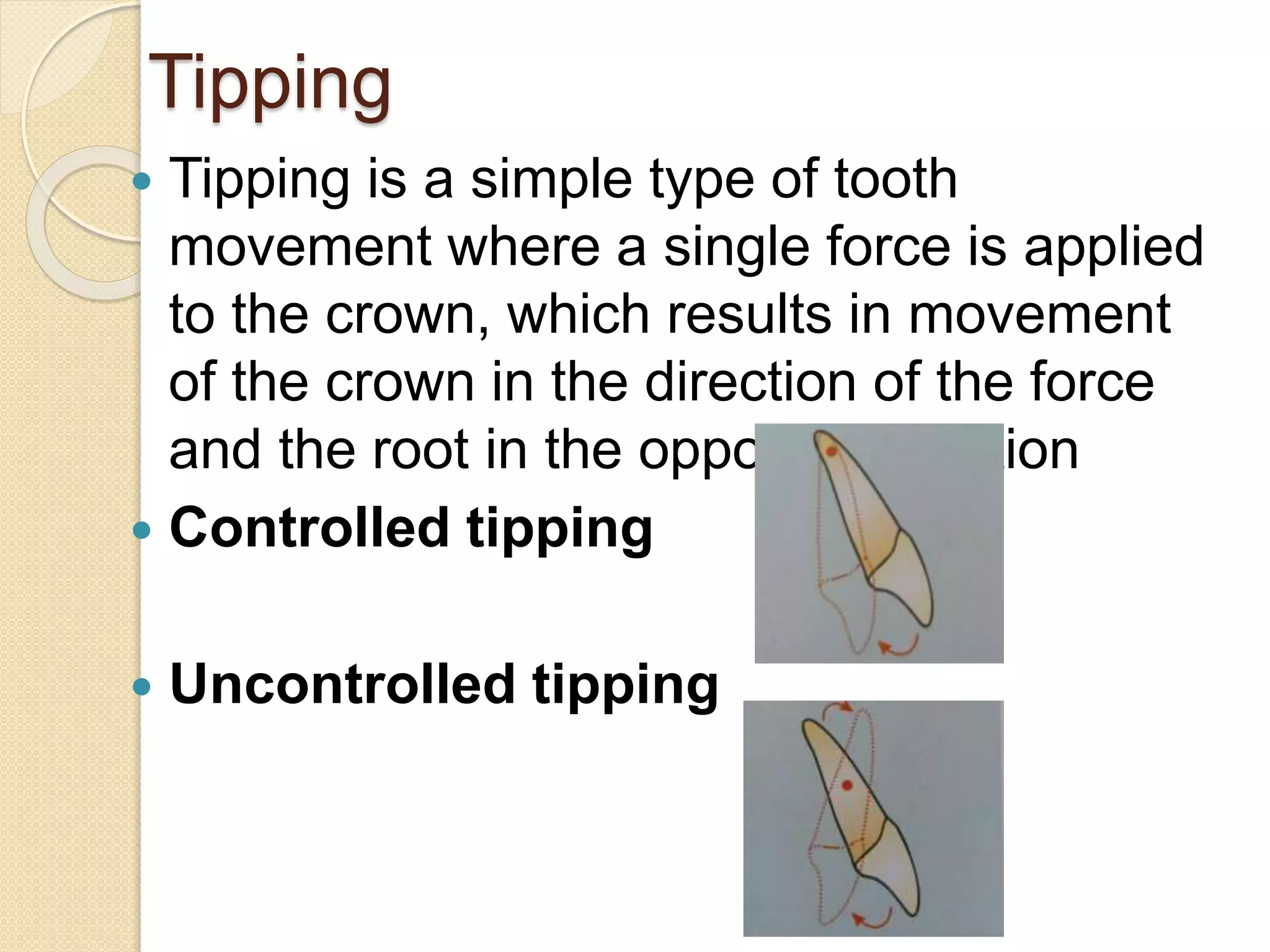 Mechanics of orthodontic tooth movement | PPTX