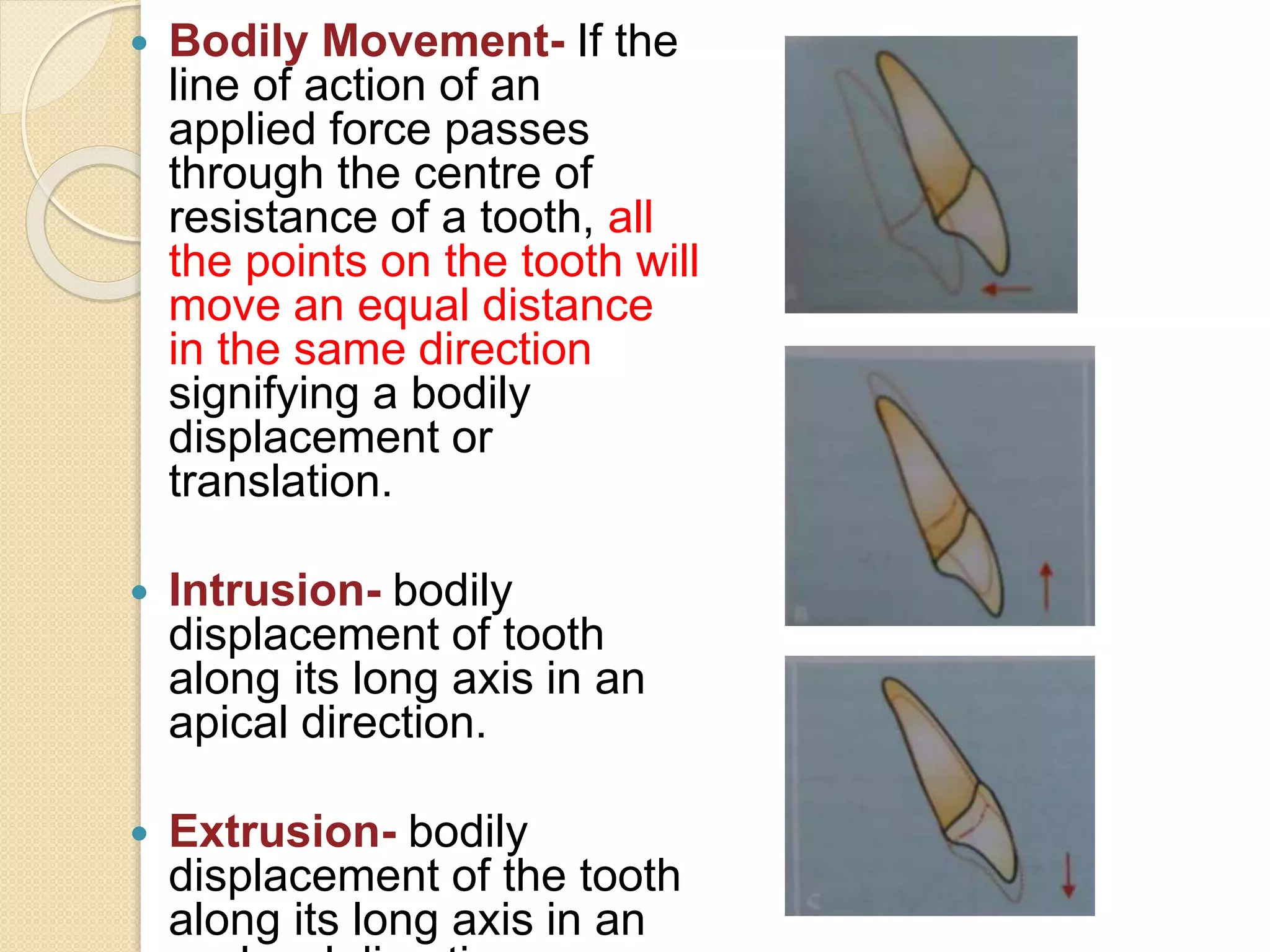 Mechanics of orthodontic tooth movement | PPTX