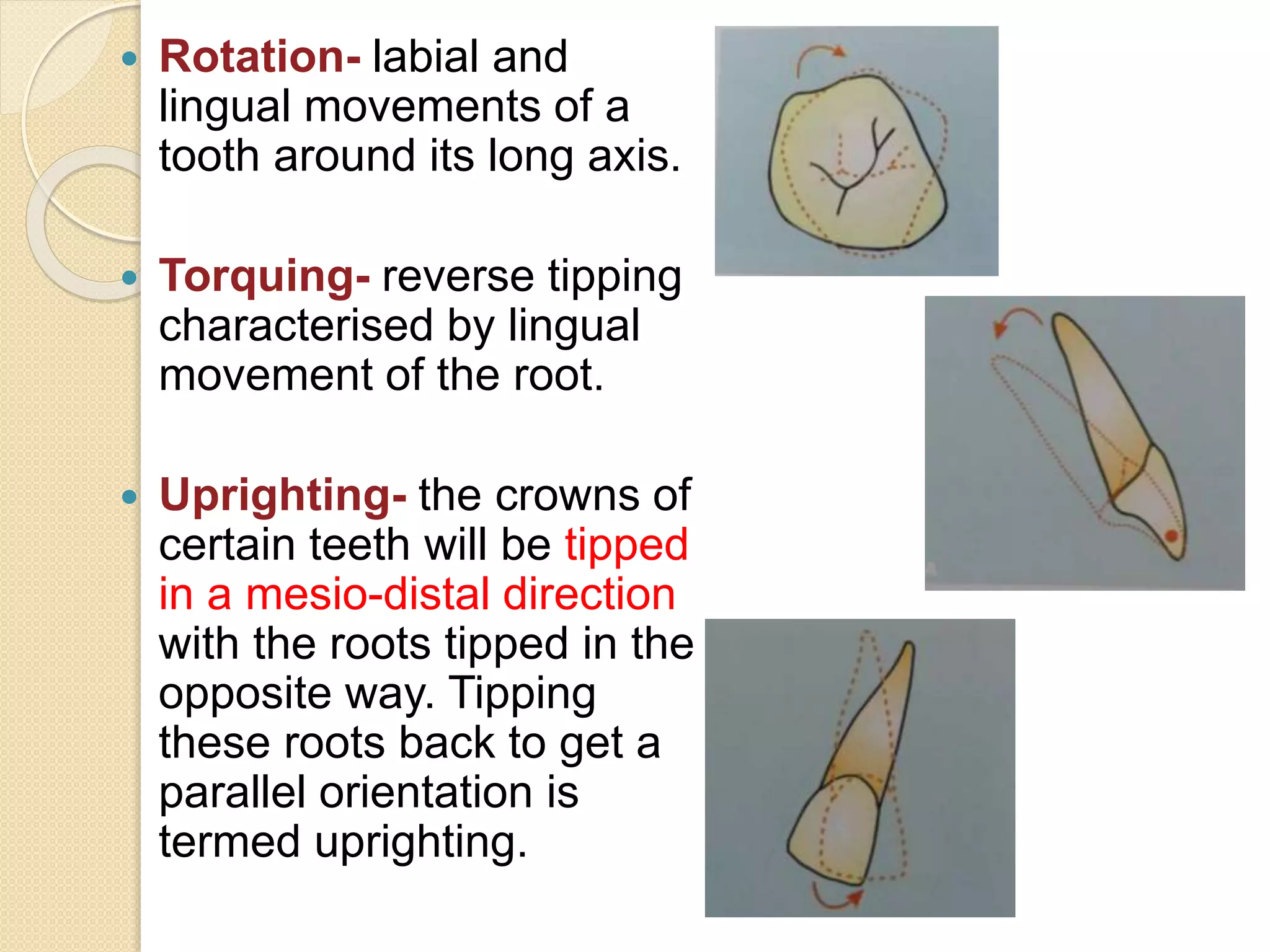 Mechanics of orthodontic tooth movement | PPTX