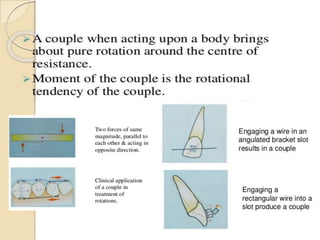 Mechanics of orthodontic tooth movement | PPTX