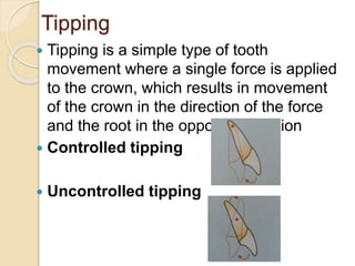 Mechanics of orthodontic tooth movement | PPTX