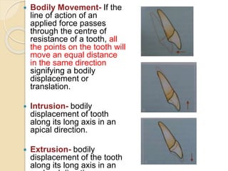 Mechanics of orthodontic tooth movement | PPTX