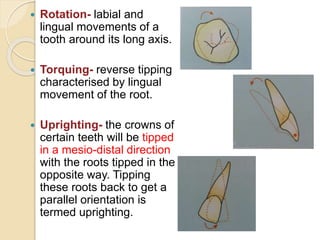 Mechanics of orthodontic tooth movement | PPTX
