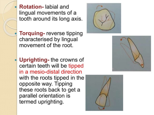 Mechanics of orthodontic tooth movement | PPTX