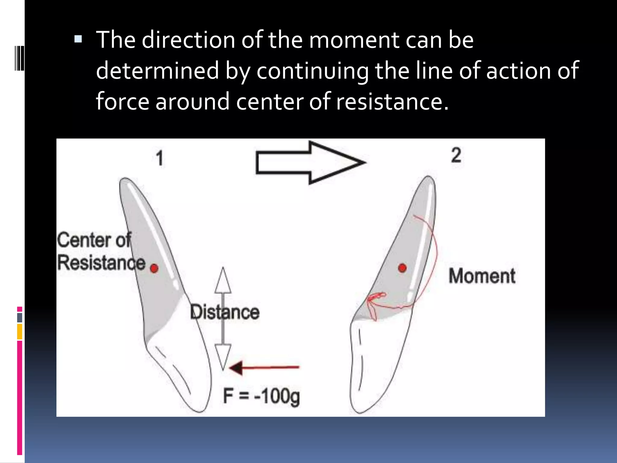 Mechanics of tooth movement | PPTX