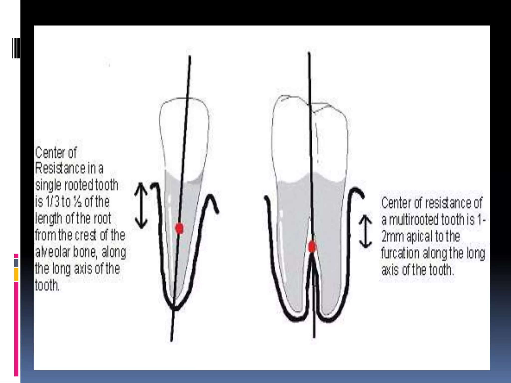 Mechanics of tooth movement | PPTX