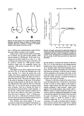 Mechanics of tooth movement | PDF