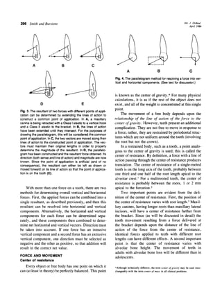Mechanics of tooth movement | PDF
