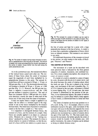 Mechanics of tooth movement | PDF