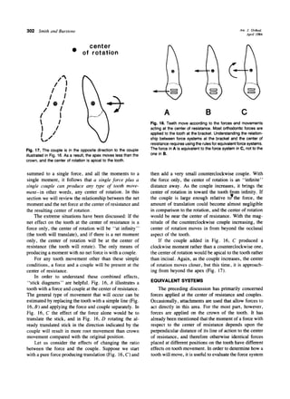 Mechanics of tooth movement | PDF