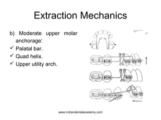 Mechanics sequence for extraction treatment | PPT | Dental Health ...