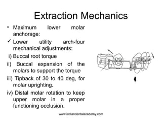 Mechanics sequence for extraction treatment | PPT