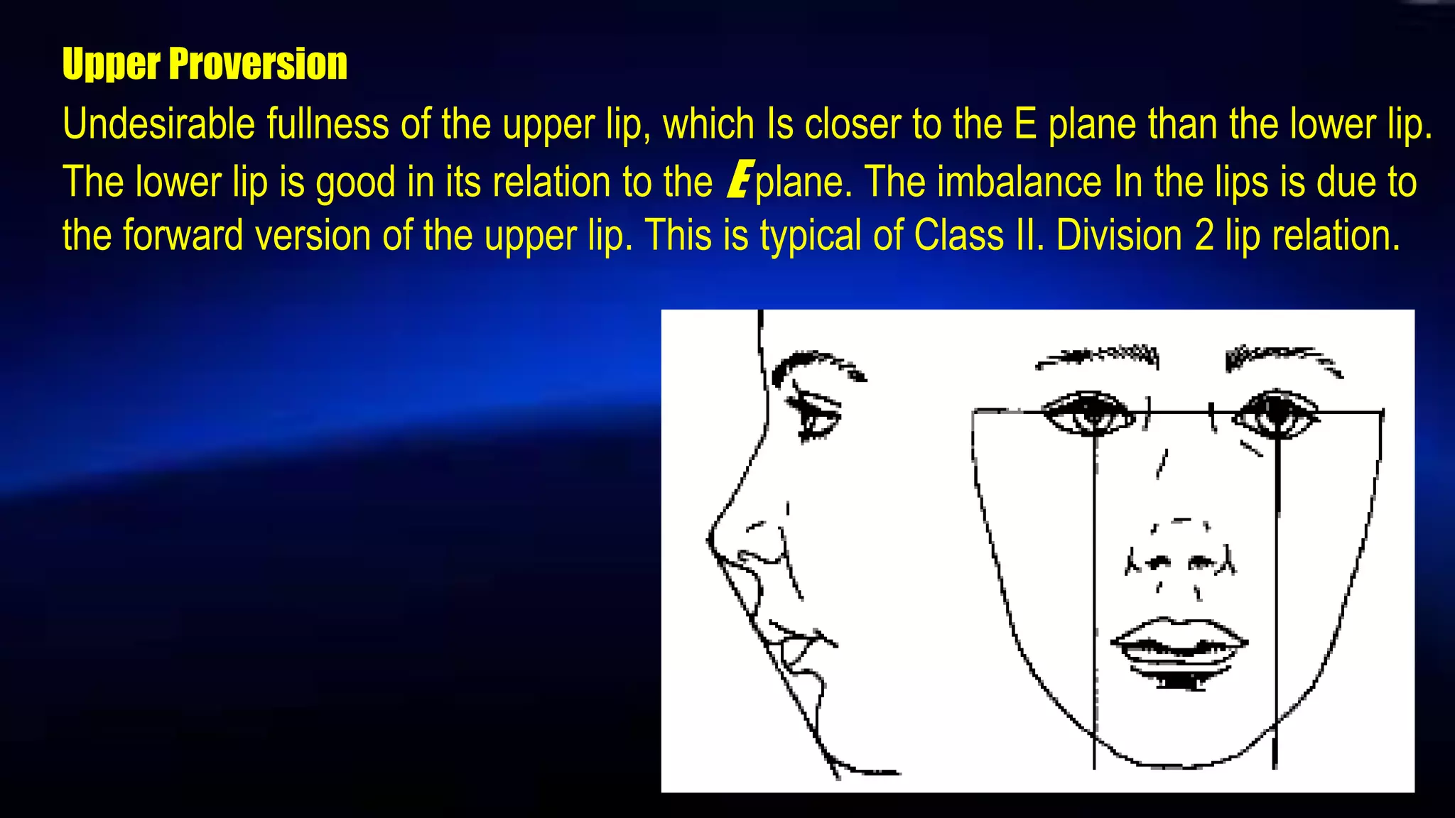 Mechanics sequence for class 2 div 2 | PPTX