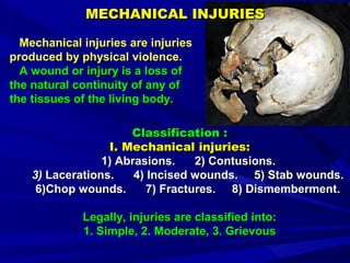 Mechan injuries 17-18сжат-1;zsmu | PPT