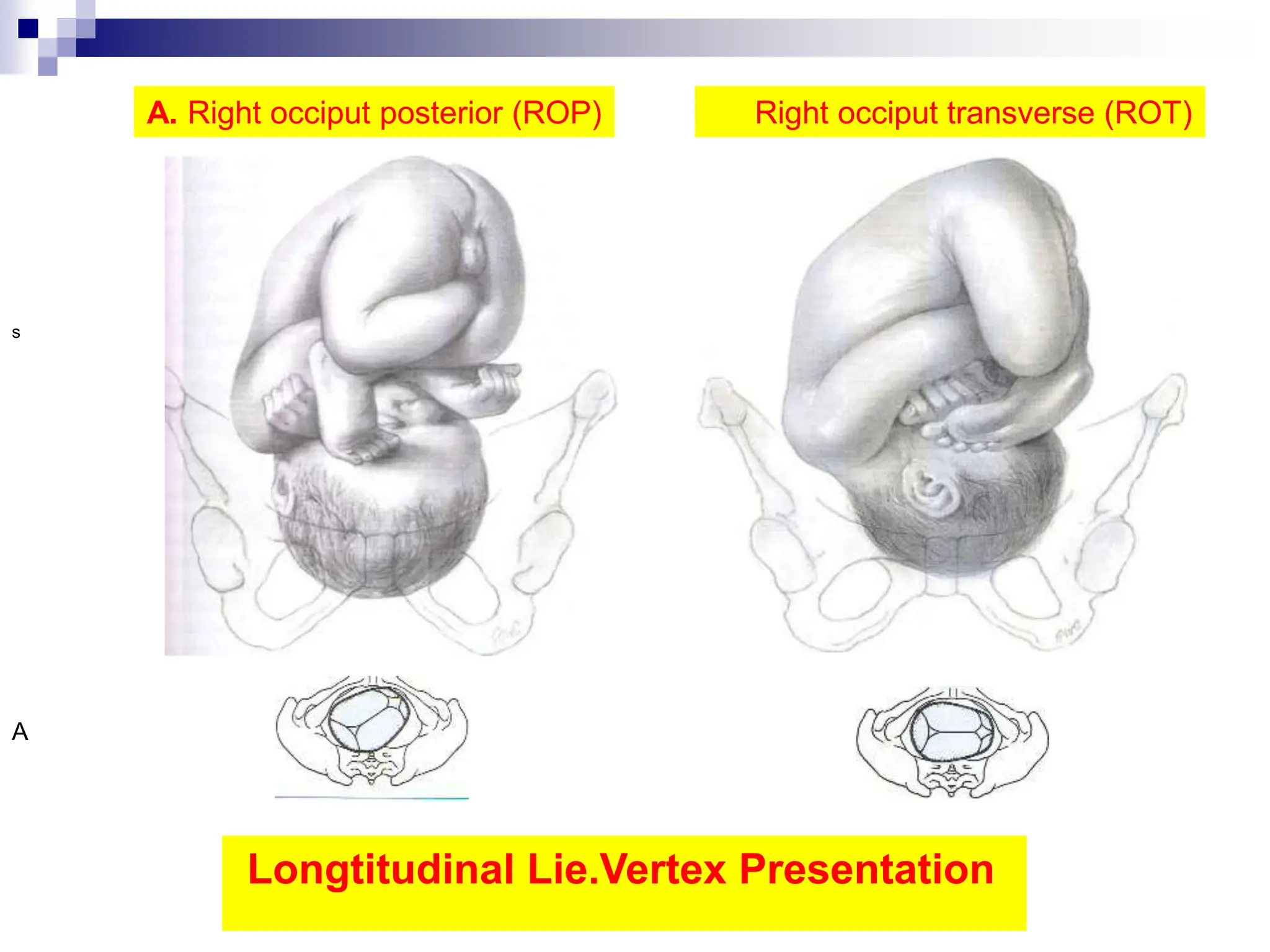mechanism-of-labour.ppt OBSTETRICS and gynaecologist | PPT