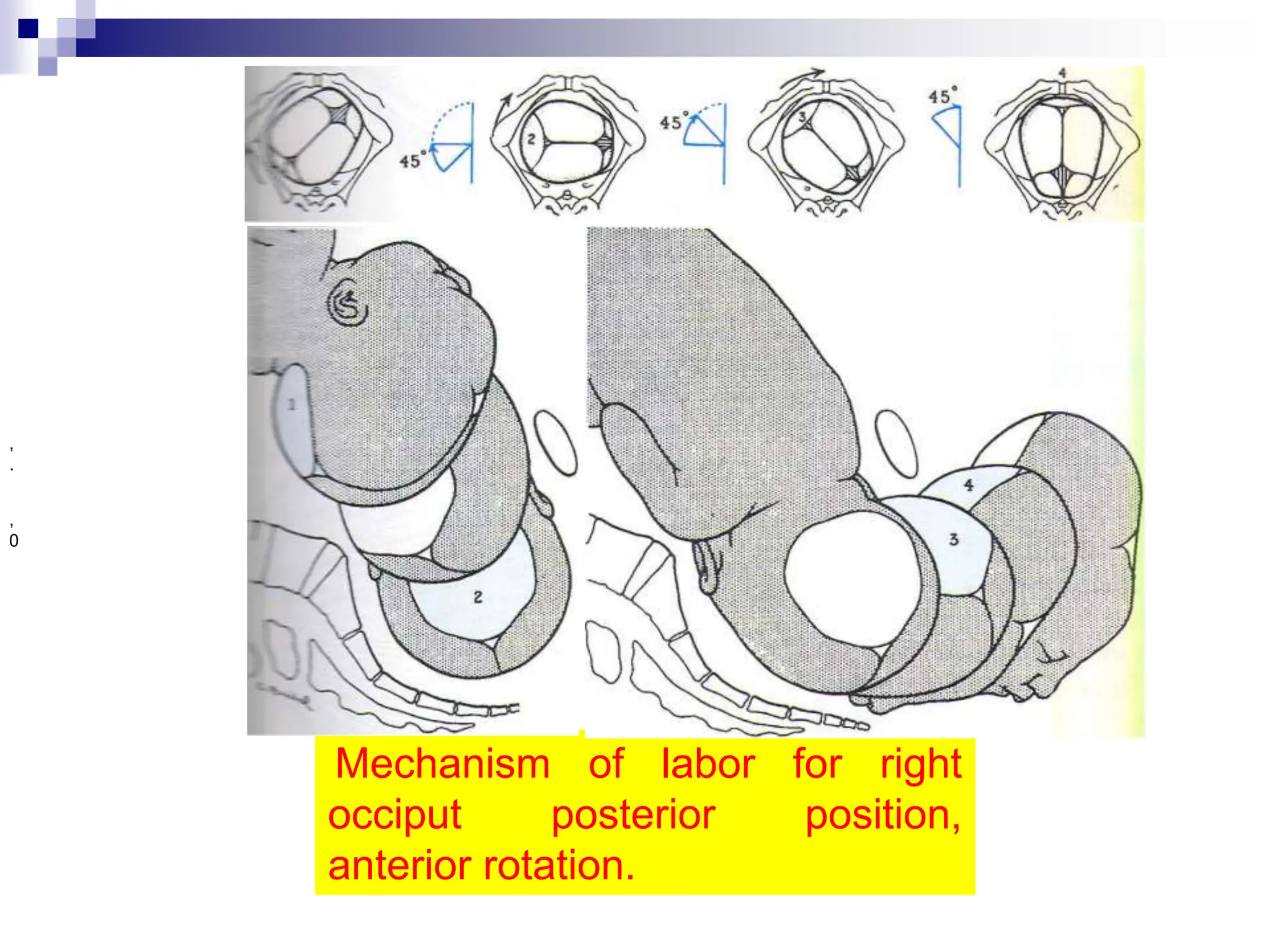 mechanism-of-labour.ppt OBSTETRICS and gynaecologist | PPT