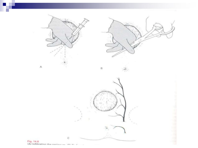 mechanism-of-labour.ppt OBSTETRICS and gynaecologist | PPT