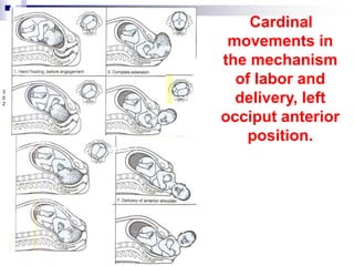 mechanism-of-labour.ppt OBSTETRICS and gynaecologist | PPT