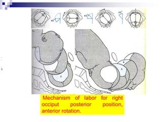 mechanism-of-labour.ppt OBSTETRICS and gynaecologist | PPT