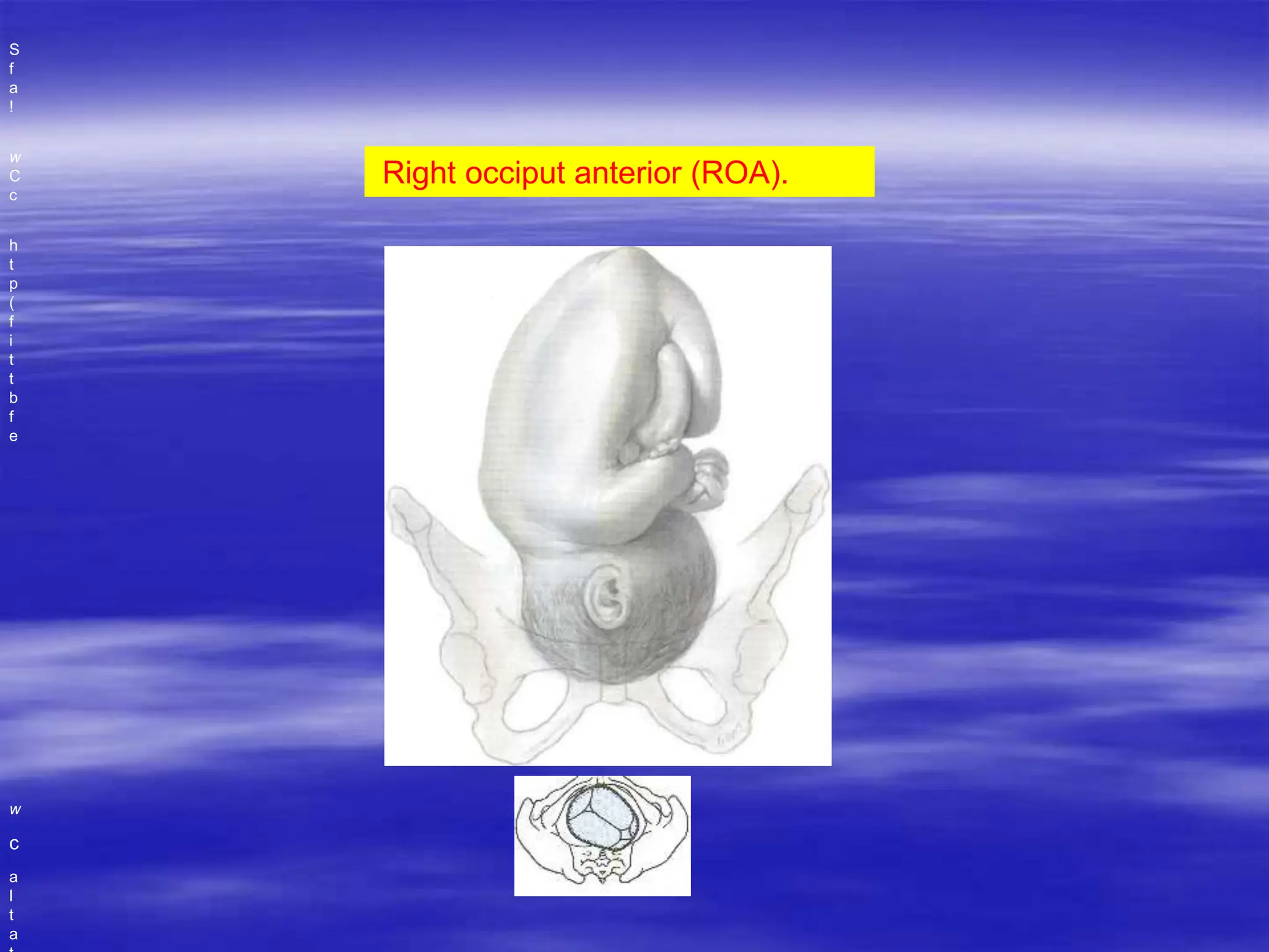 mechanism-of-labour-normal-and-abnormal.ppt