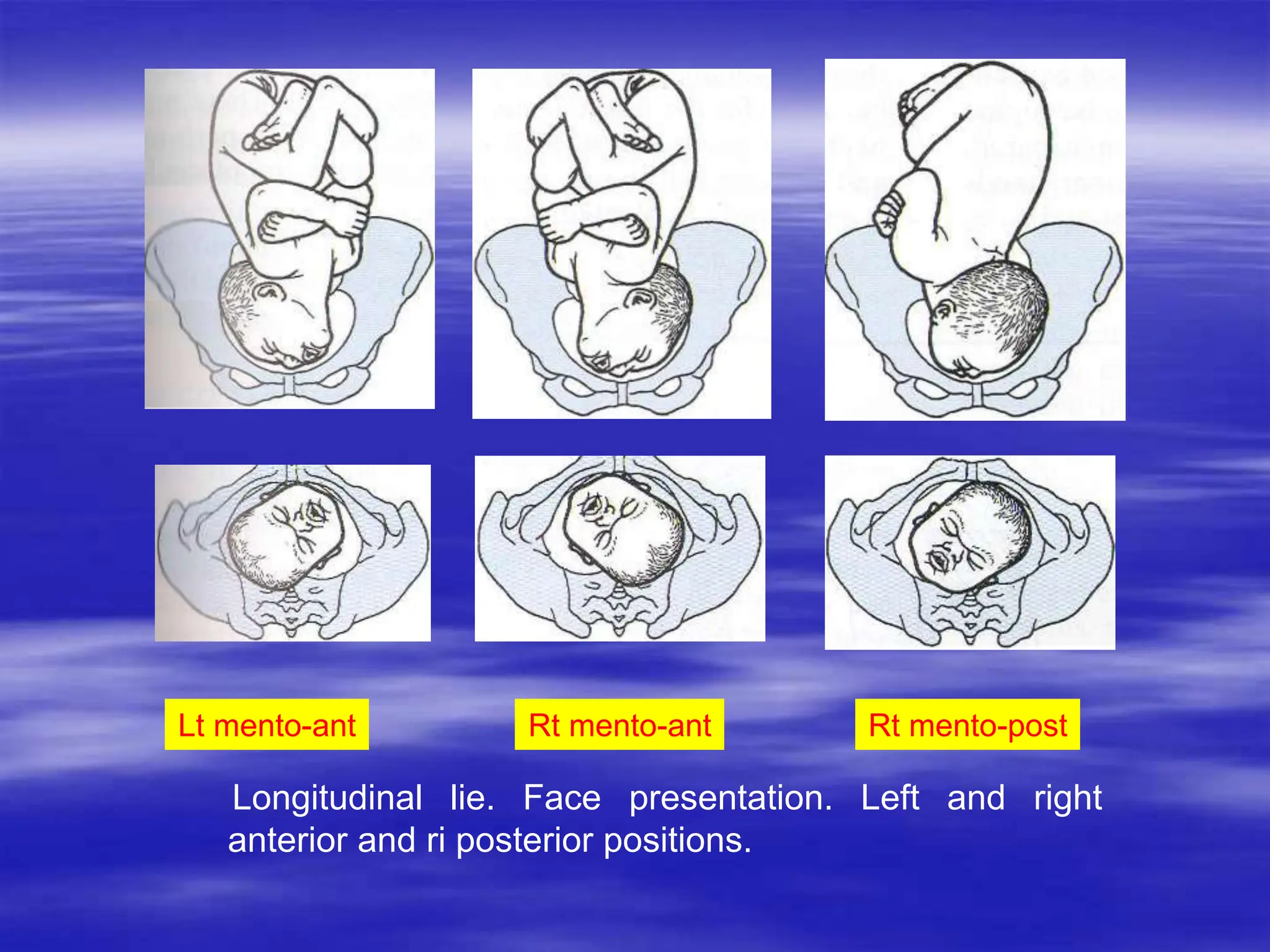 mechanism-of-labour-normal-and-abnormal.ppt