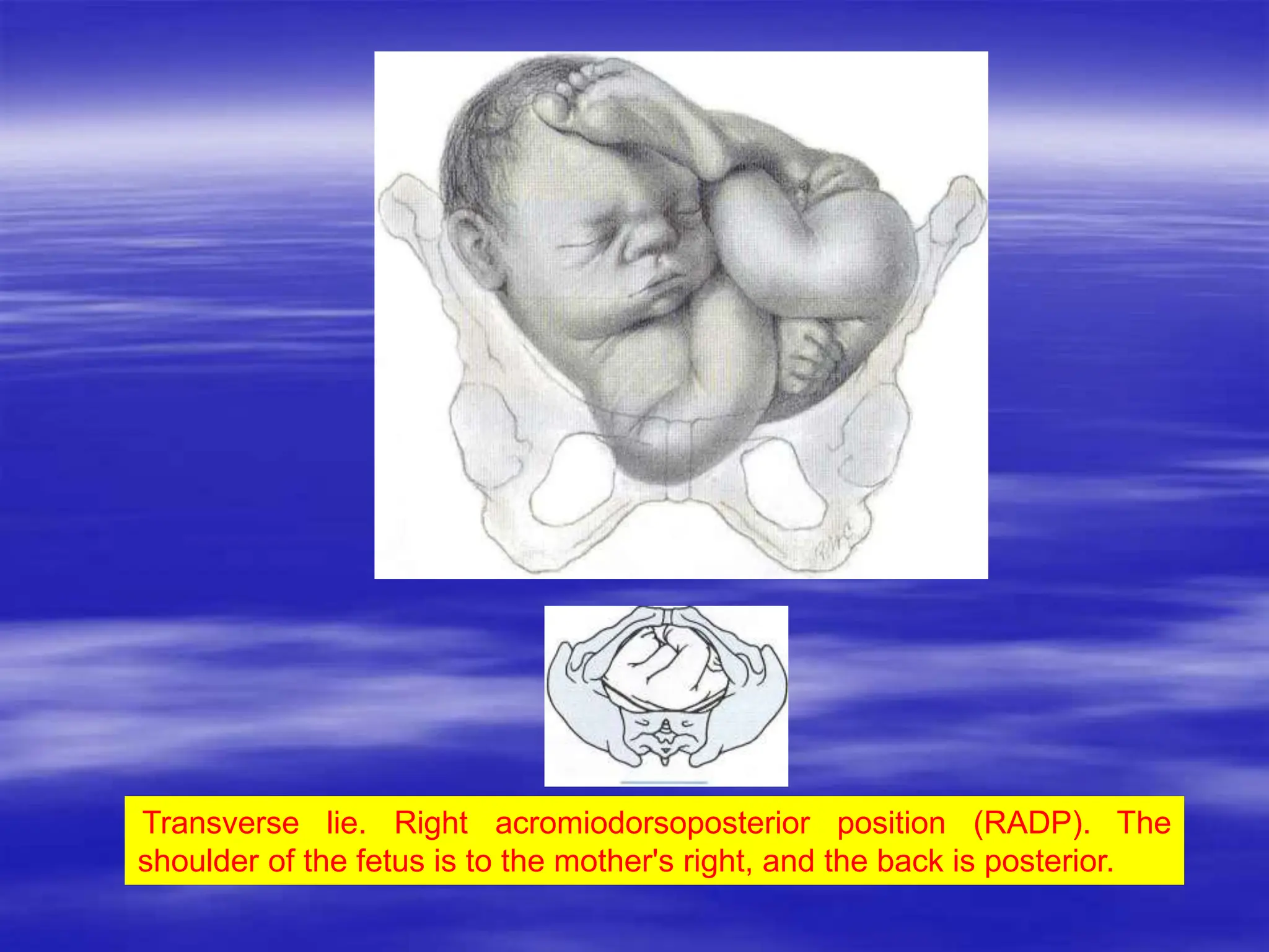 mechanism-of-labour-normal-and-abnormal.ppt