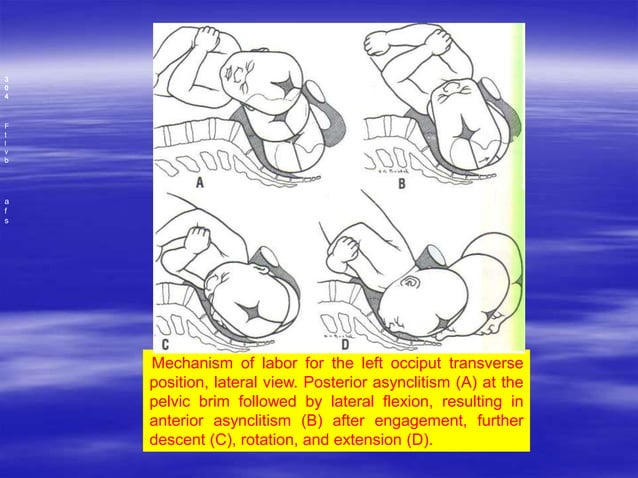 mechanism-of-labour-normal-and-abnormal.ppt