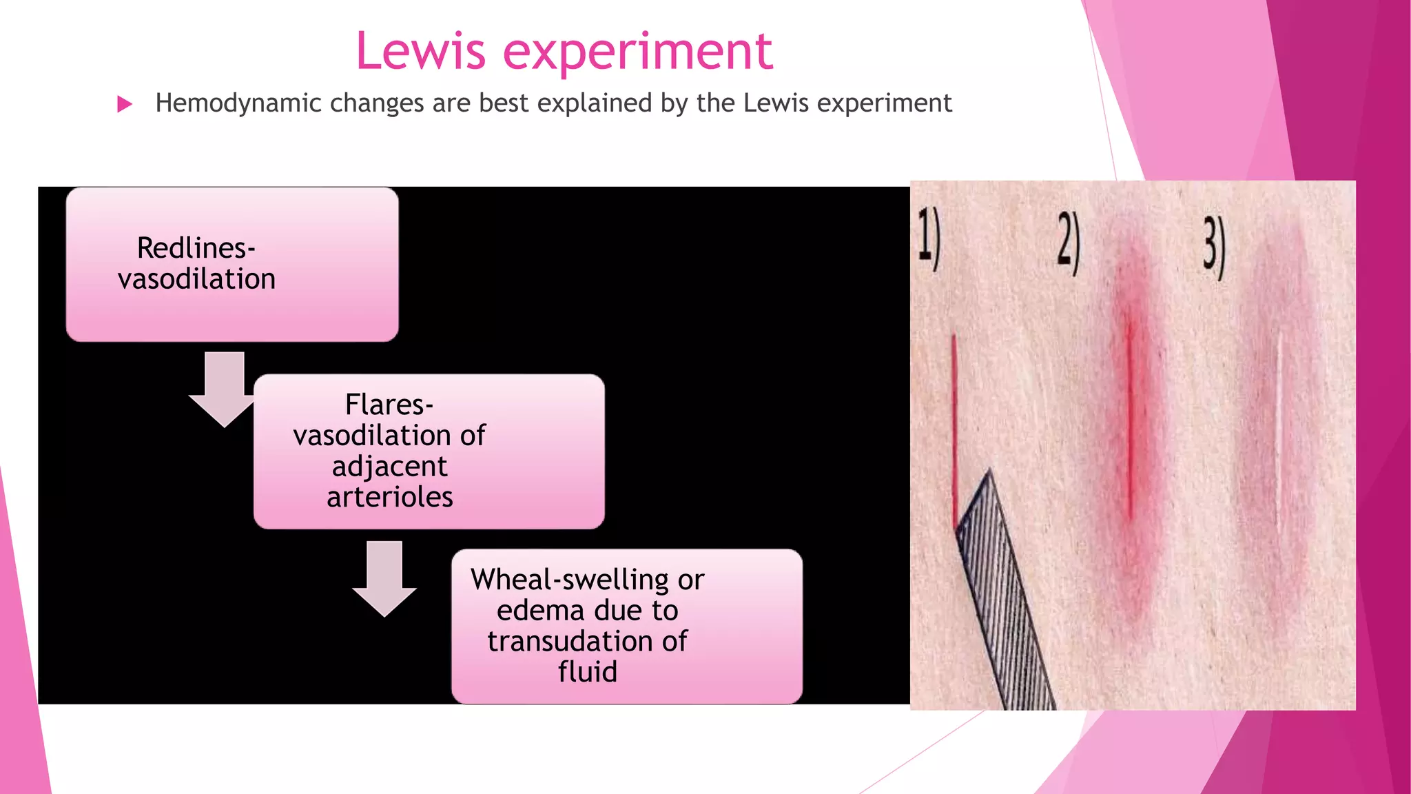 Mechanism involved in the process of inflammation lecture 5 | PPTX ...