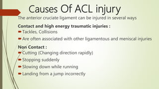 Mechanism of ACL InjURY | PPTX