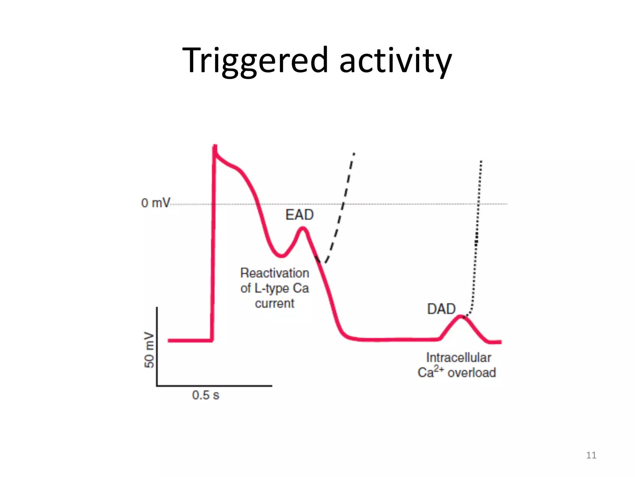 Mechanism of Arrhythmias .pdf