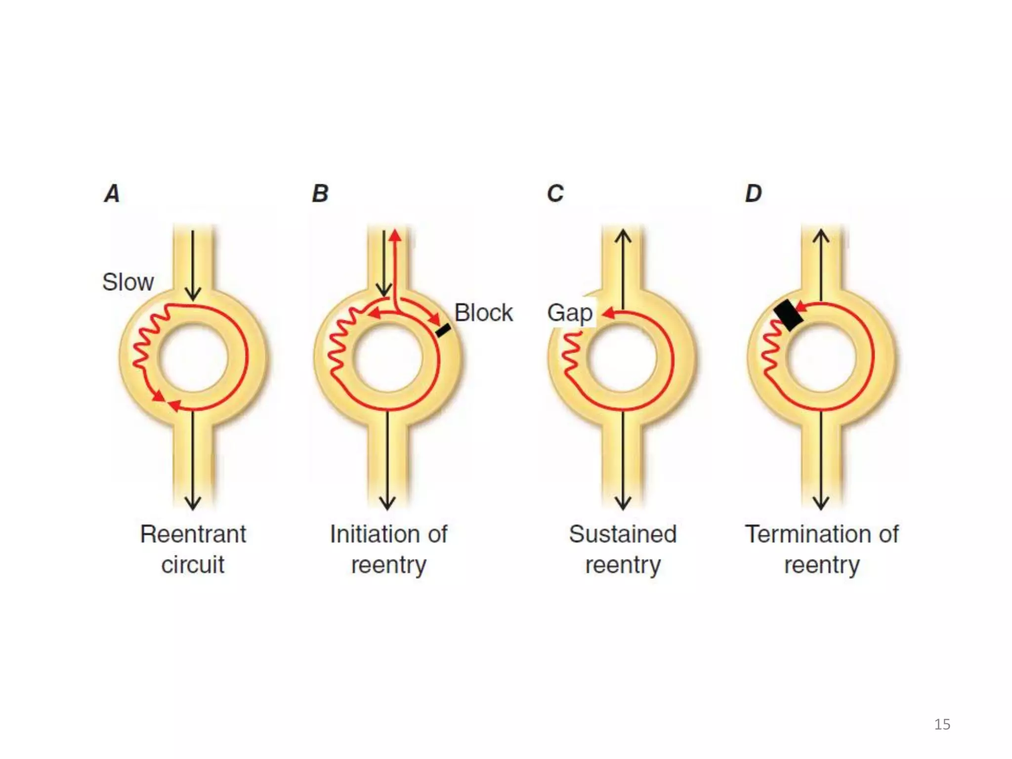 Mechanism of Arrhythmias .pdf