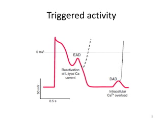 Mechanism of Arrhythmias .pdf